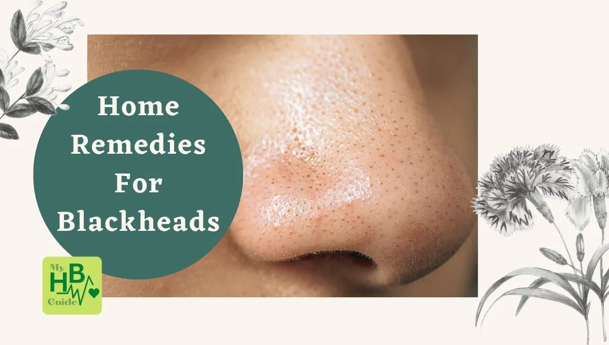 Home Remedies For Blackheads Remove In 5 Minutes